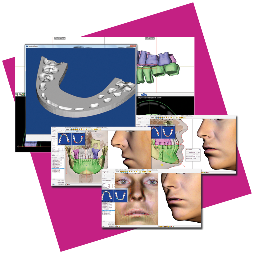 Dolphin 3D - Dolphin Imaging | El Software dental preferido por los ...